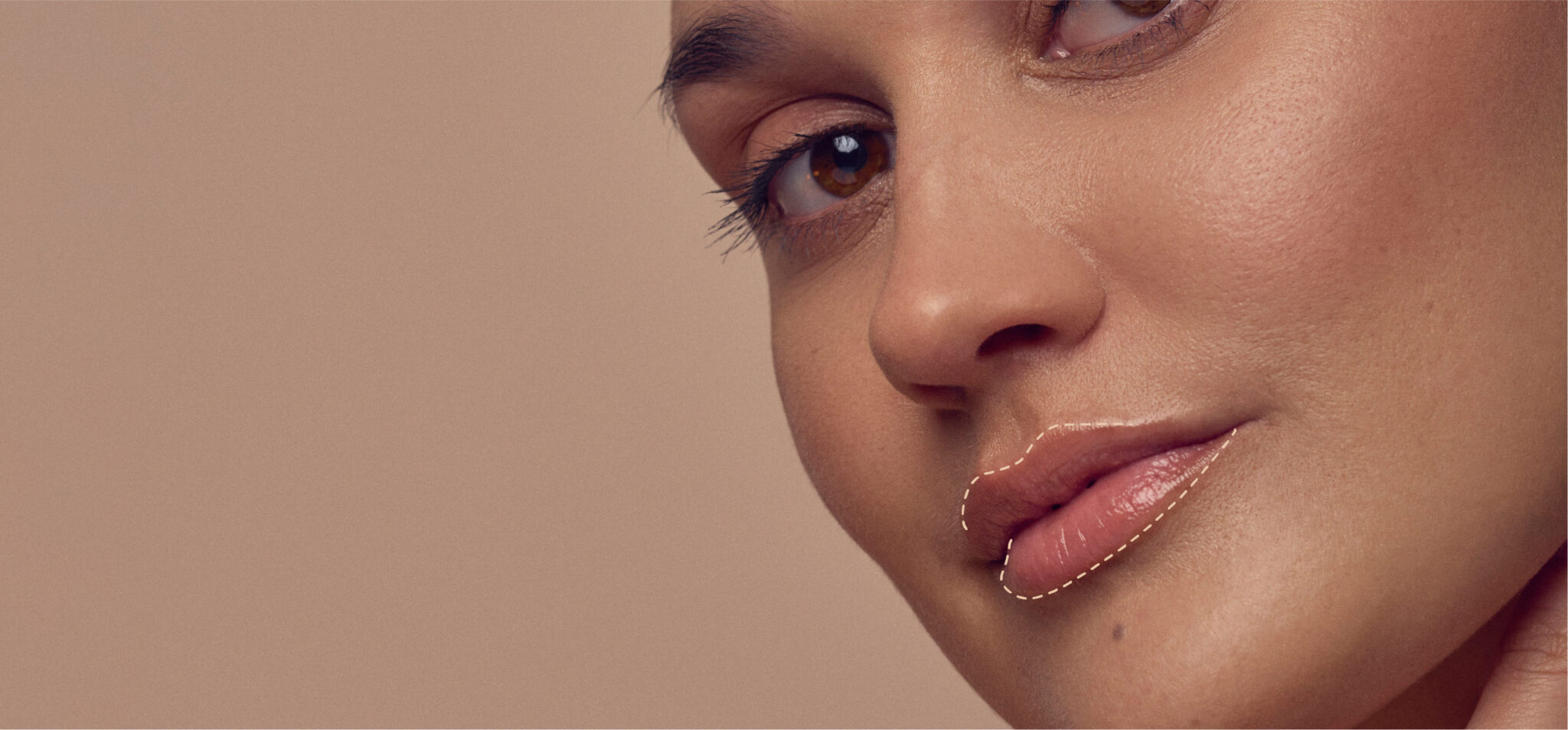 Non-Surgical Lip Augmentation | Lip Filler | Cosmetic Connection