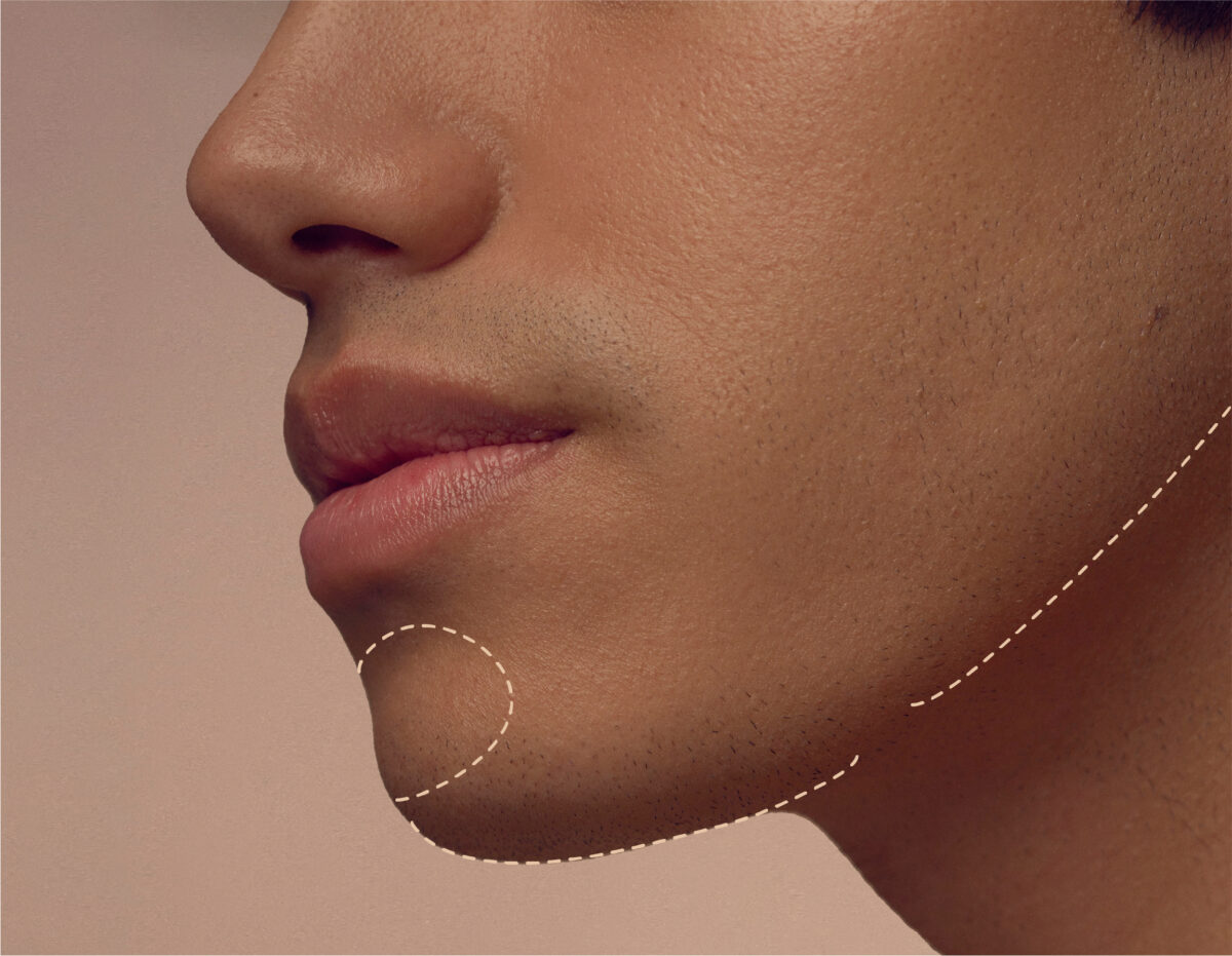 Double Chin Fat Treatment | Cosmetic Connection