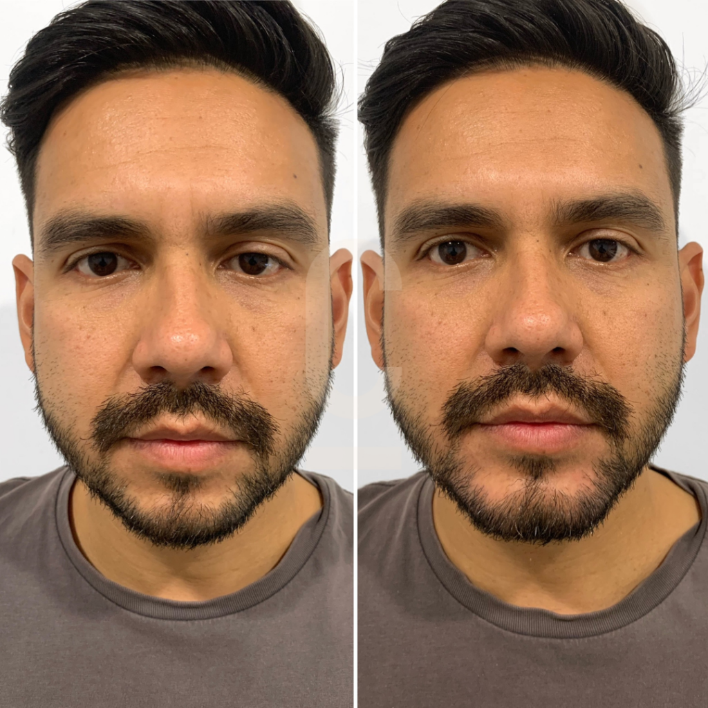 Facial balancing - Cosmetic Connection