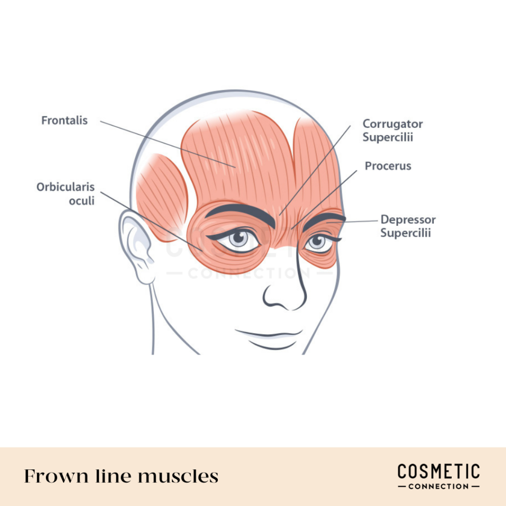 Brow Line Wrinkle Solutions - Cosmetic Connection