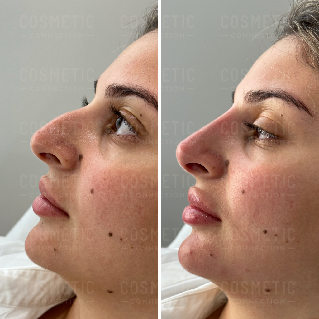 Facial Balancing | Cosmetic Connection